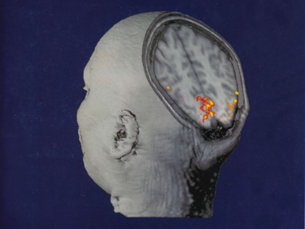 fMRI Origins – The Martinos Story